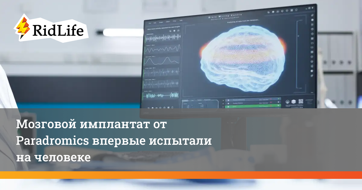Мозговой имплантат от Paradromics впервые испытали на человеке